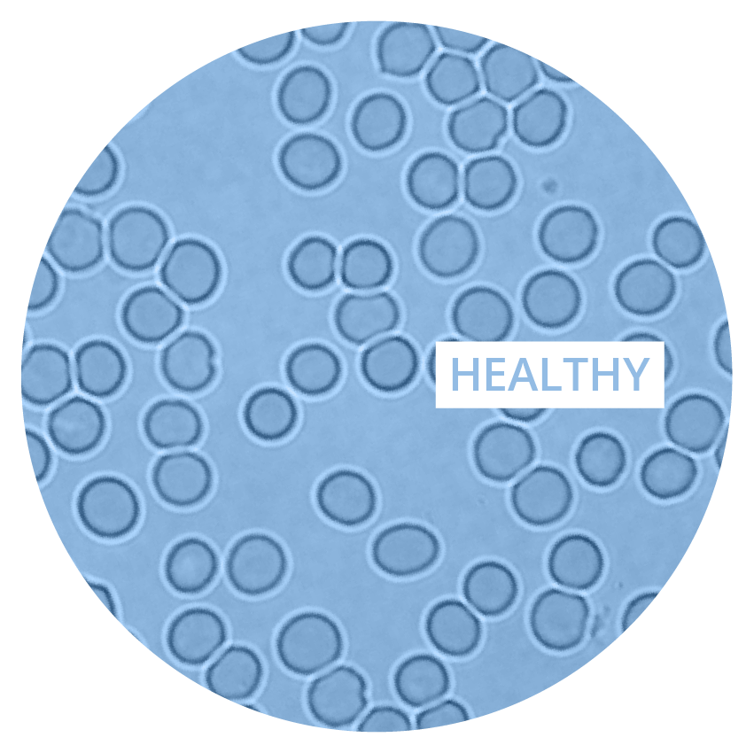 Live Blood Analysis – b.wellness